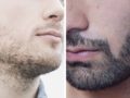 Goatee-Bart: Typische Merkmale und Varianten - FASHIONBOXX
